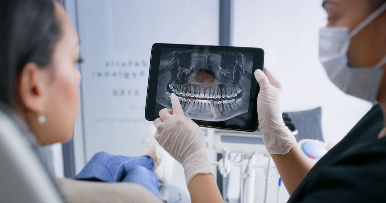 What Is An Occlusal Tooth Surface? - Canatella Dental